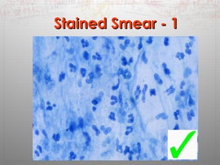 Microscopy smear examination 2014 | PPT
