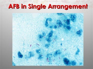 Microscopy smear examination 2014 | PPT