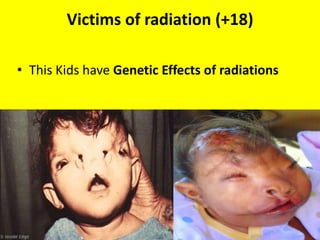 RADIATION | PPTX