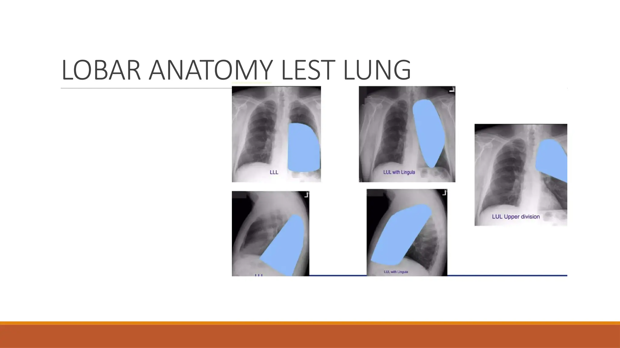Structures seen on plain chest xray pa view.pptx