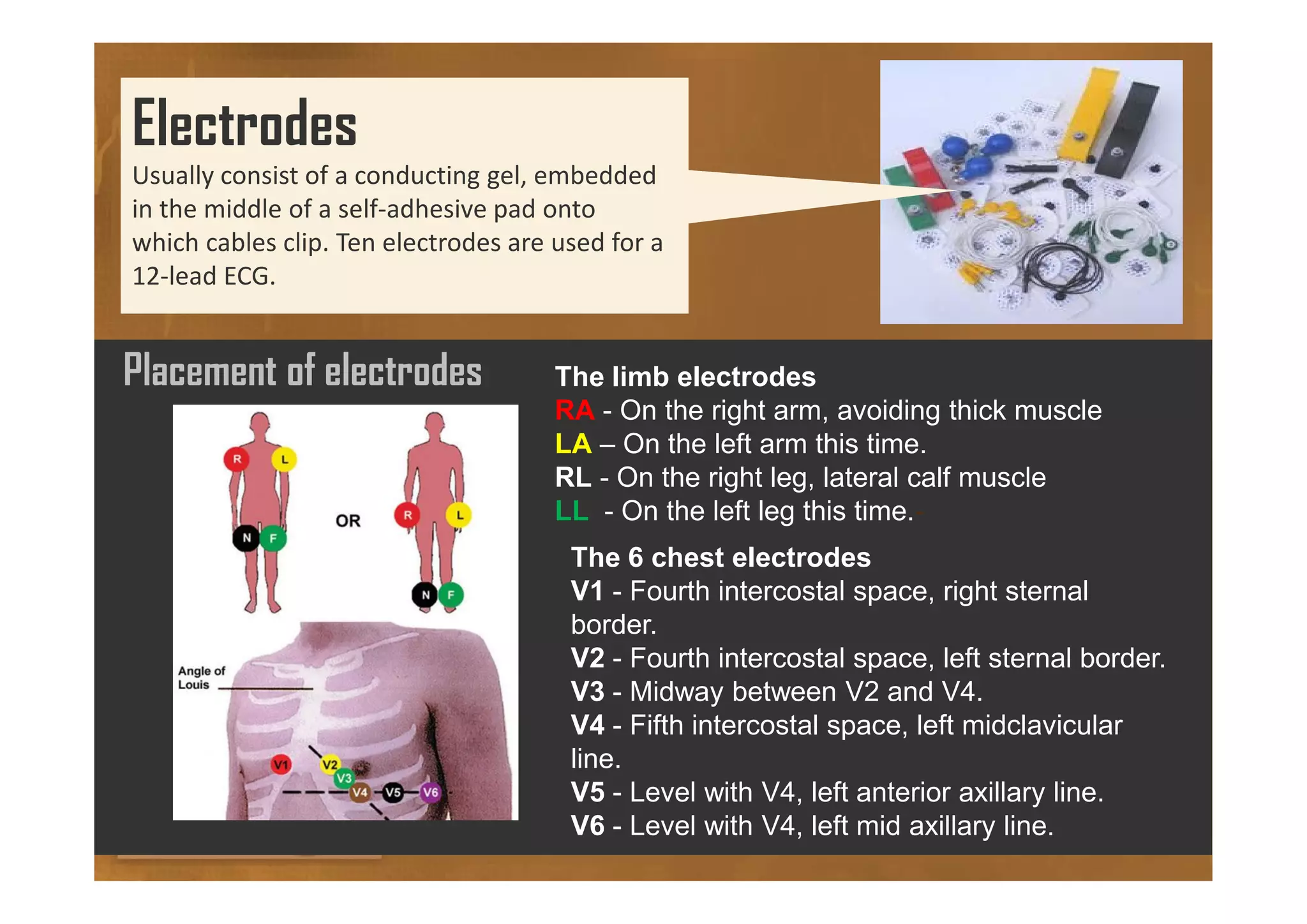 Basics of ECG | PPT