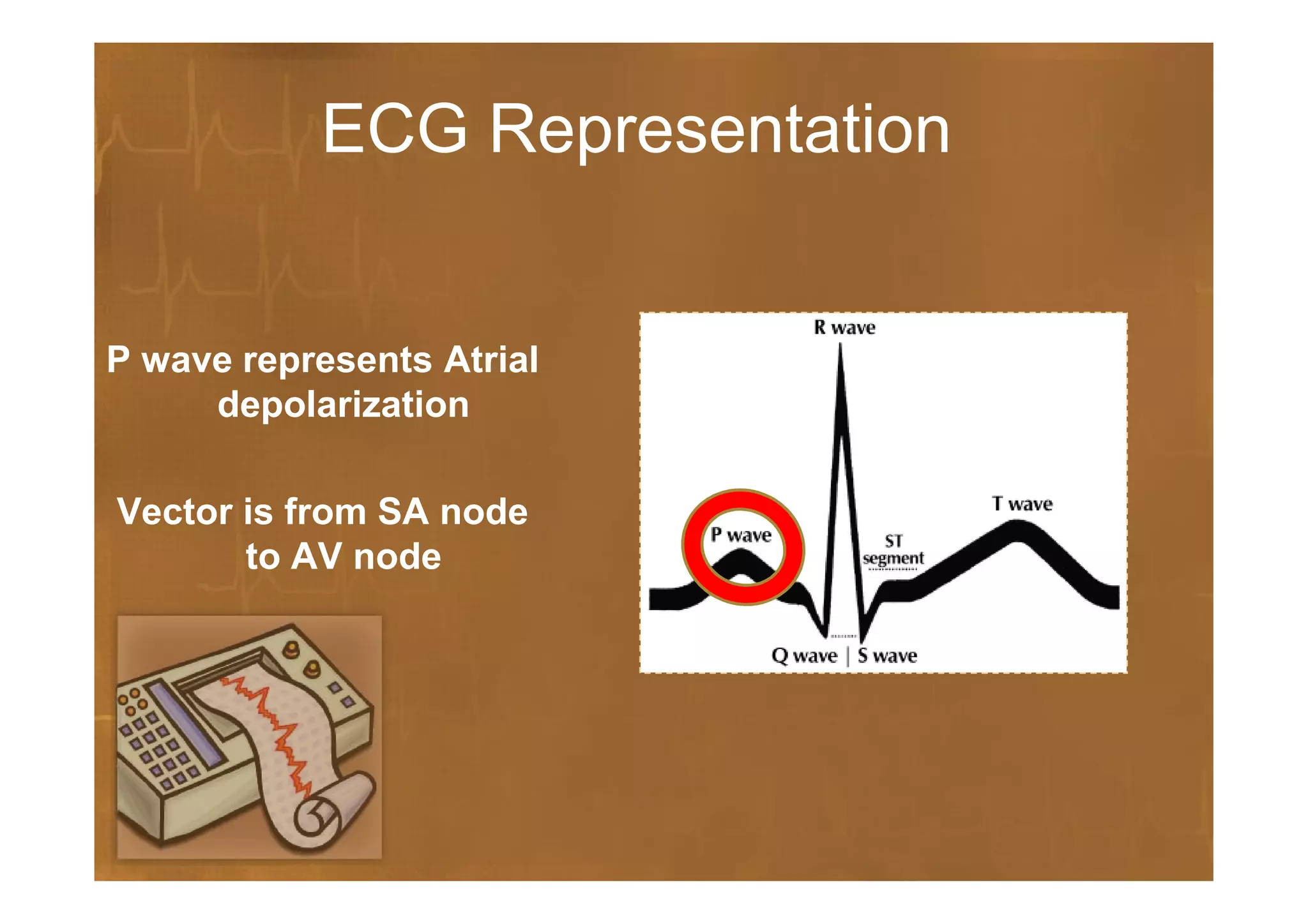 Basics of ECG | PDF | Heart and Cardiovascular Diseases | Diseases and ...