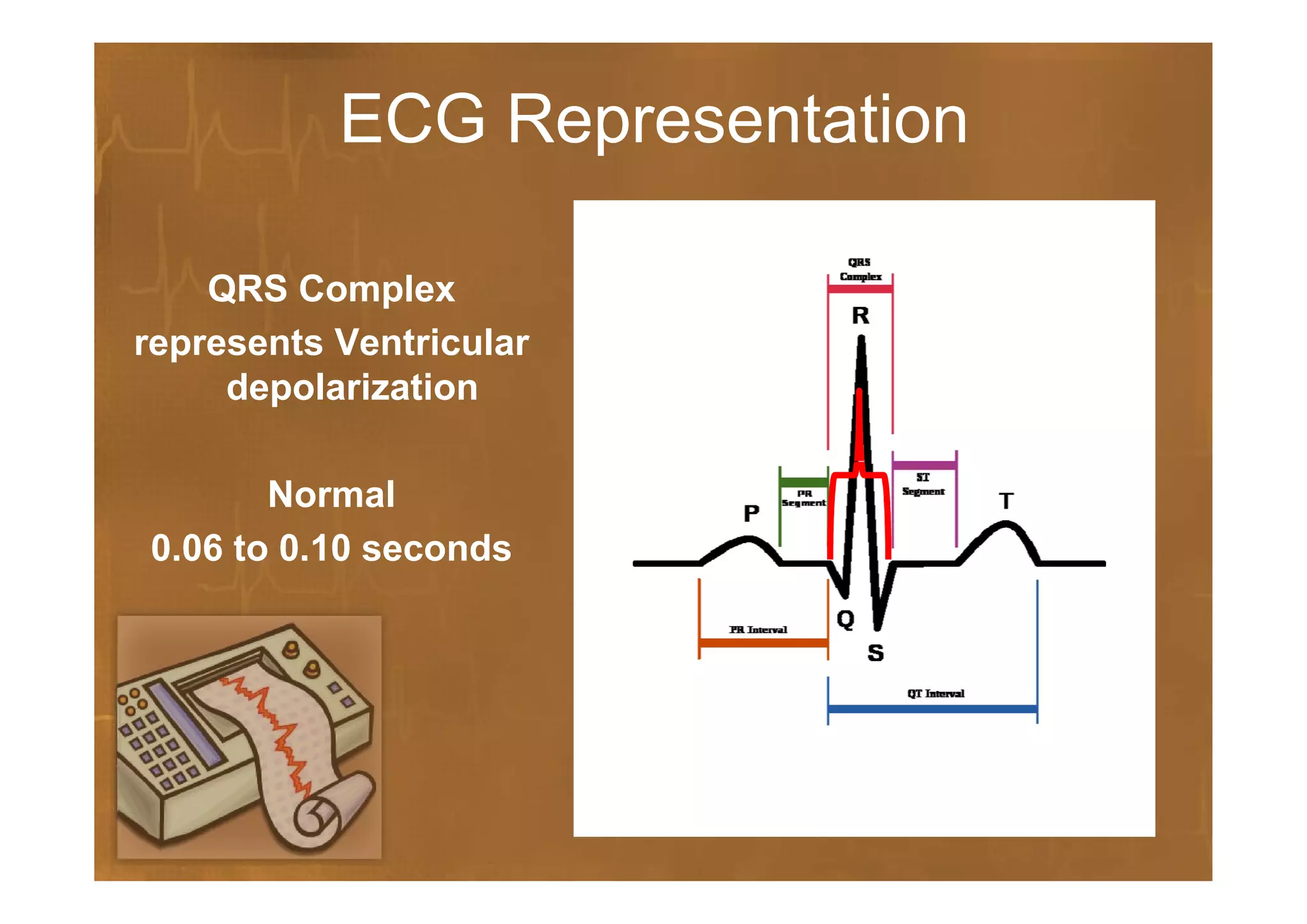 Basics of ECG | PDF