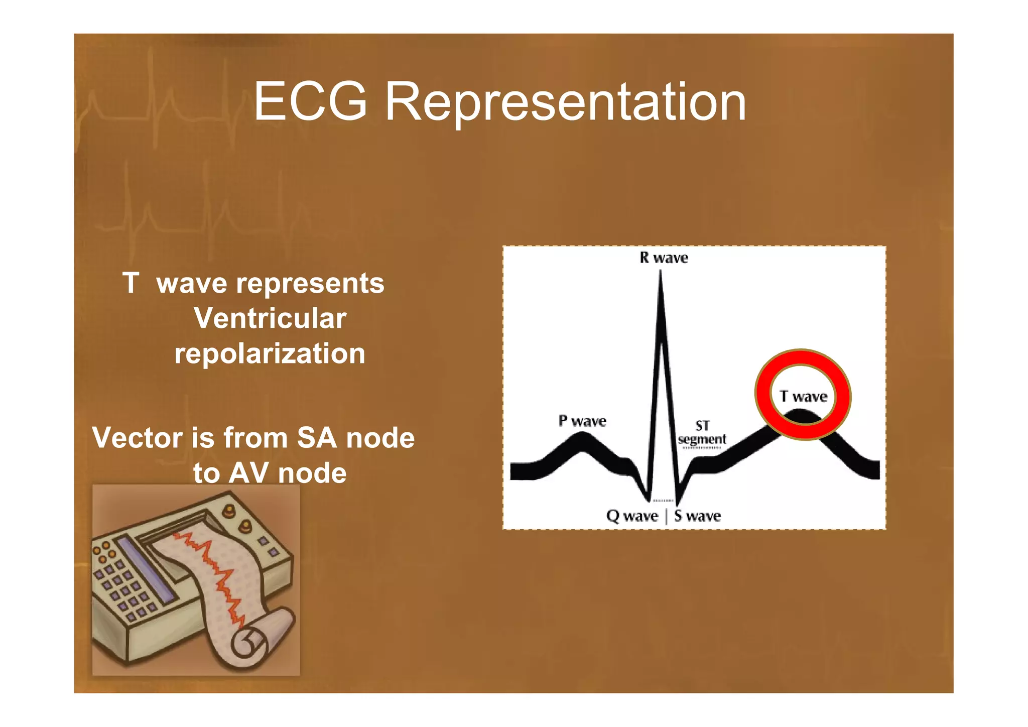 Basics of ECG | PDF