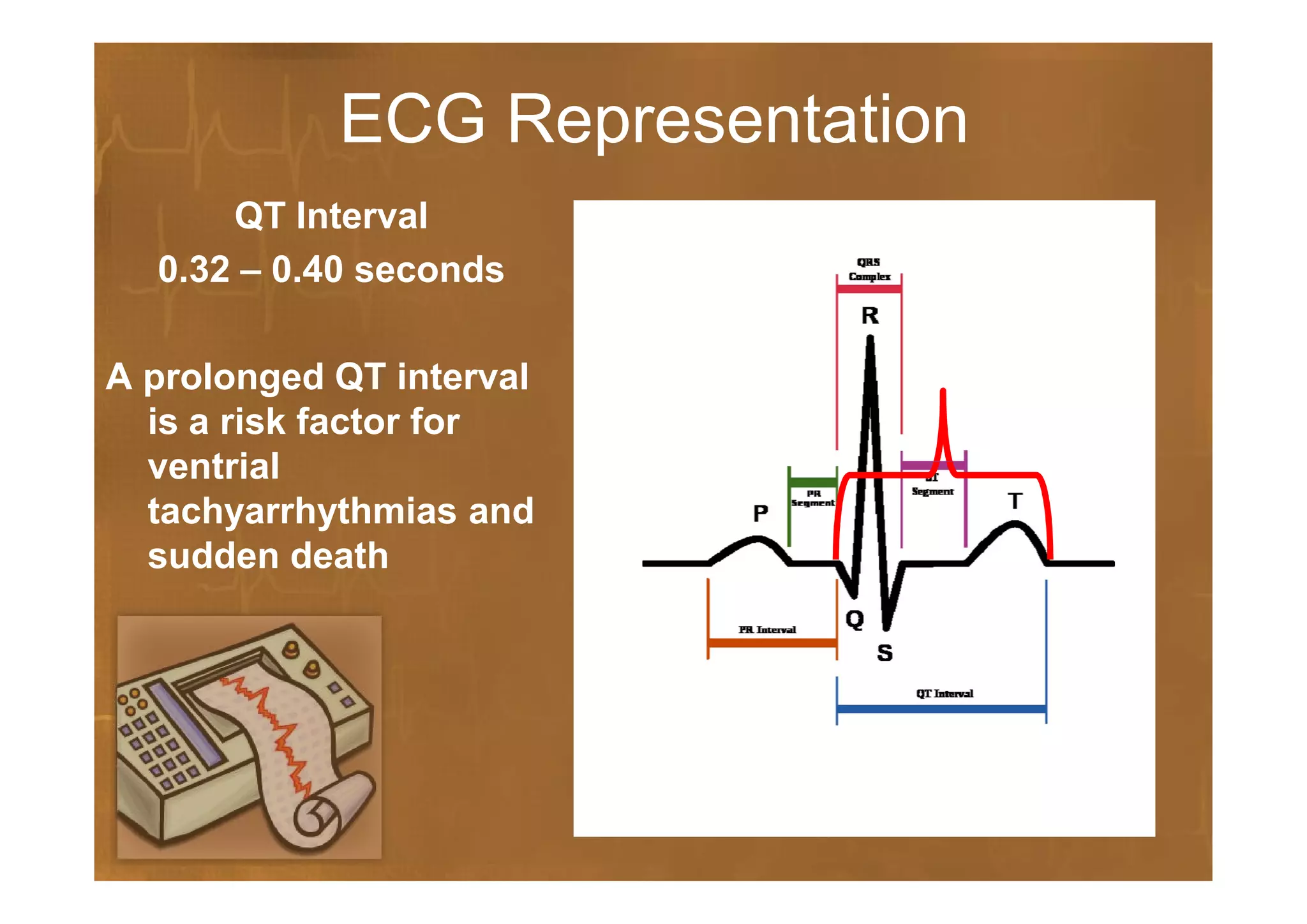 Basics of ECG | PDF