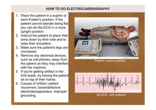 Basics of ECG | PDF