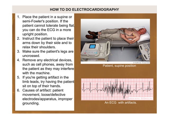 Basics of ECG | PDF | Heart and Cardiovascular Diseases | Diseases and ...
