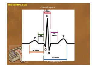 Basics of ECG | PDF