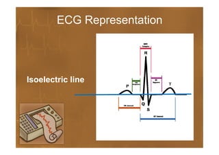 Basics of ECG | PDF