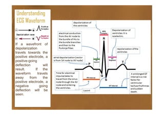 Basics of ECG | PDF