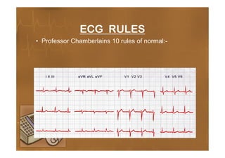 Basics of ECG | PDF
