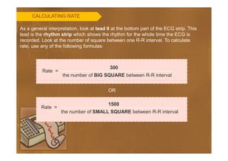 Basics of ECG | PDF