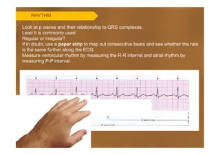 Basics of ECG | PDF