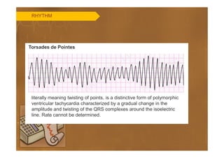 Basics of ECG | PDF