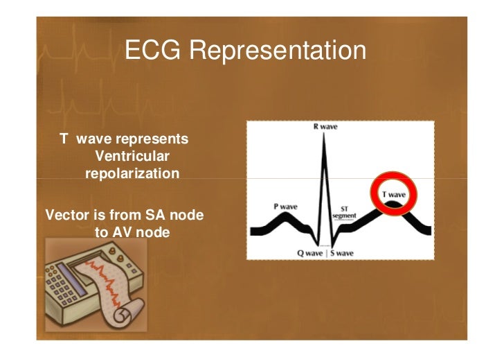 Basics of ECG