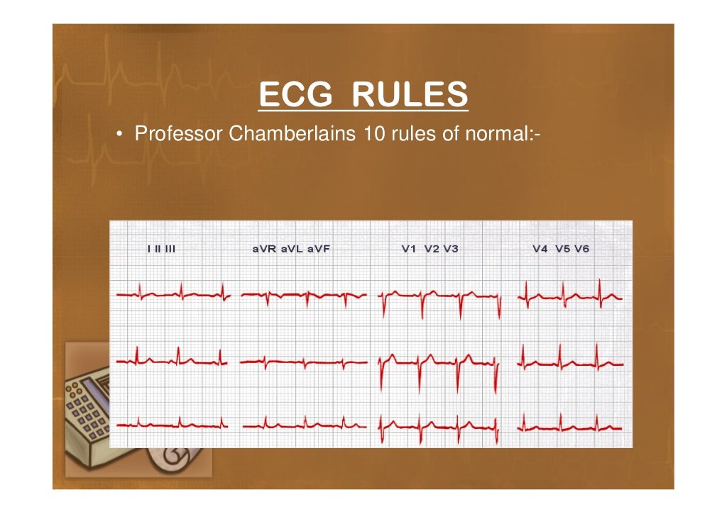 Basics of ECG