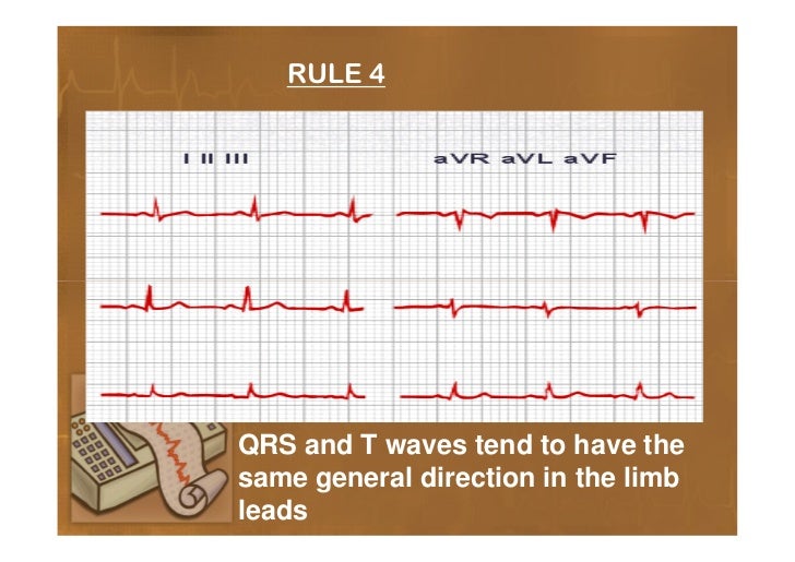 Basics of ECG