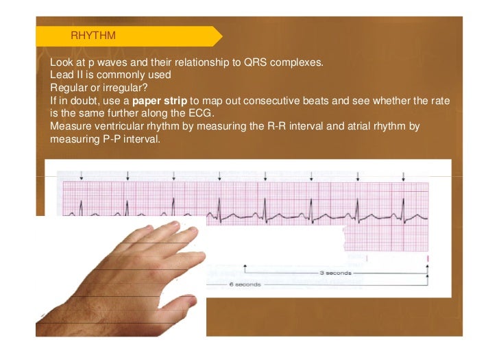 Basics of ECG