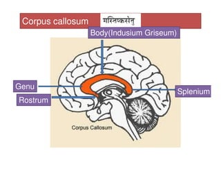 Cerebrum & lateral ventricle | PDF