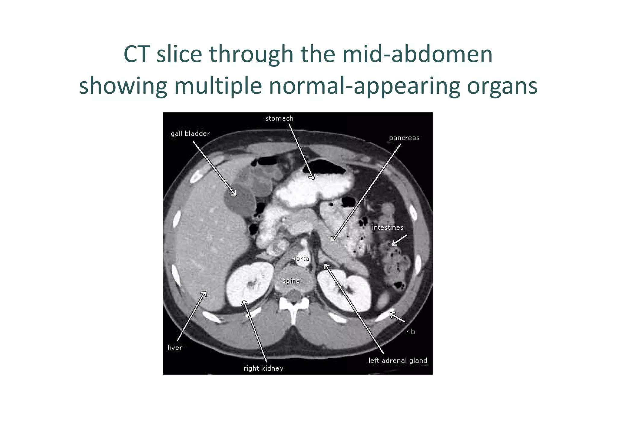 Basics of CT Scan | PDF