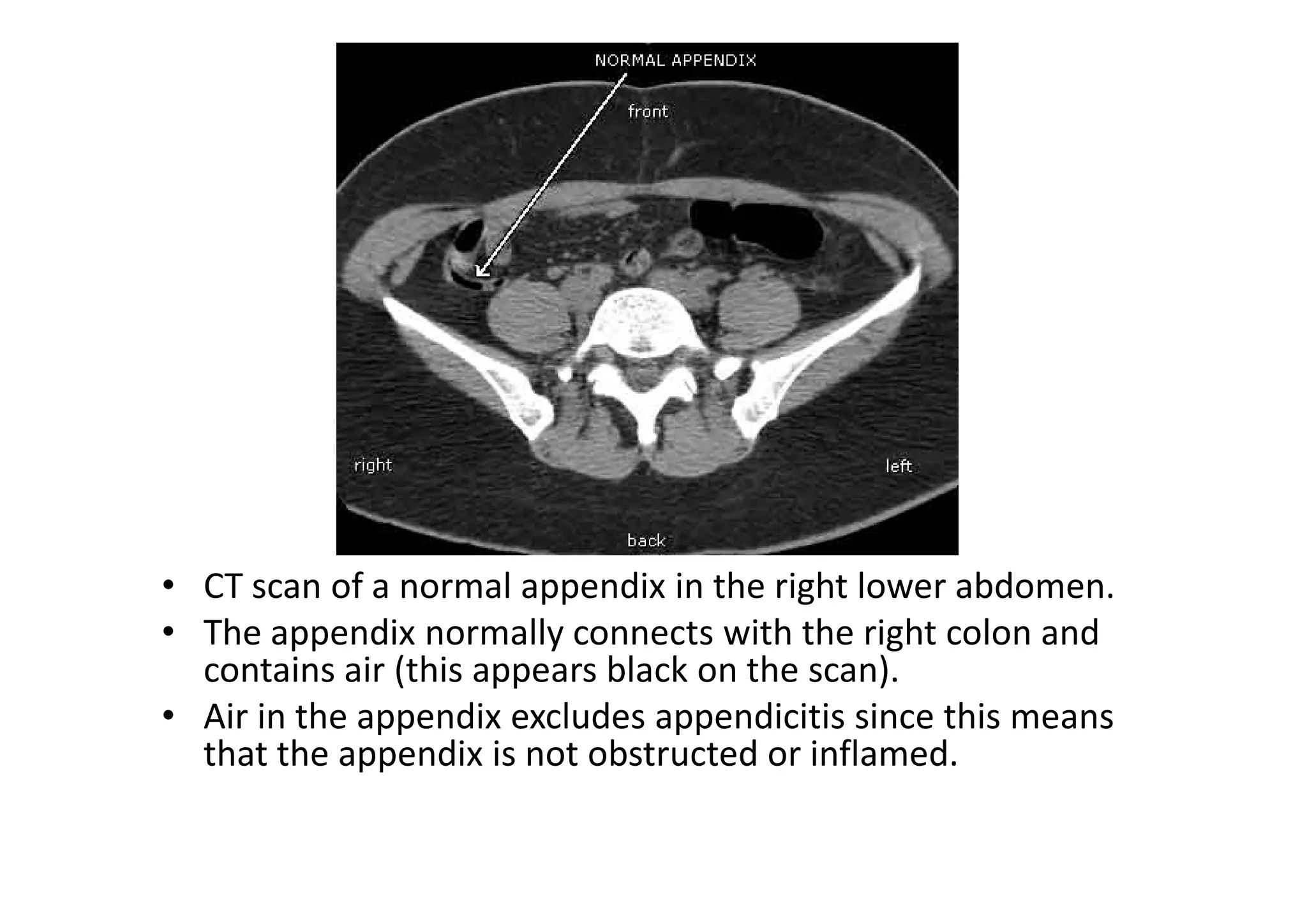 Basics of CT Scan | PDF