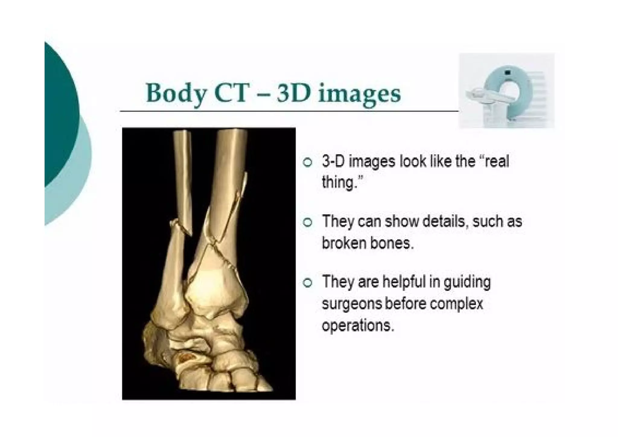 Basics of CT Scan | PDF