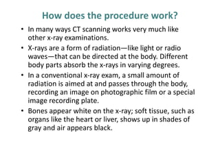 Basics of CT Scan | PDF