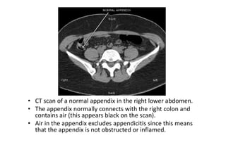 Basics of CT Scan | PDF