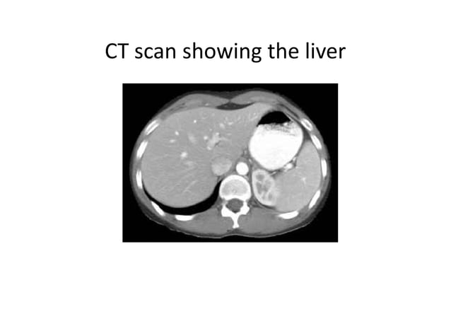 Basics of CT Scan | PPT