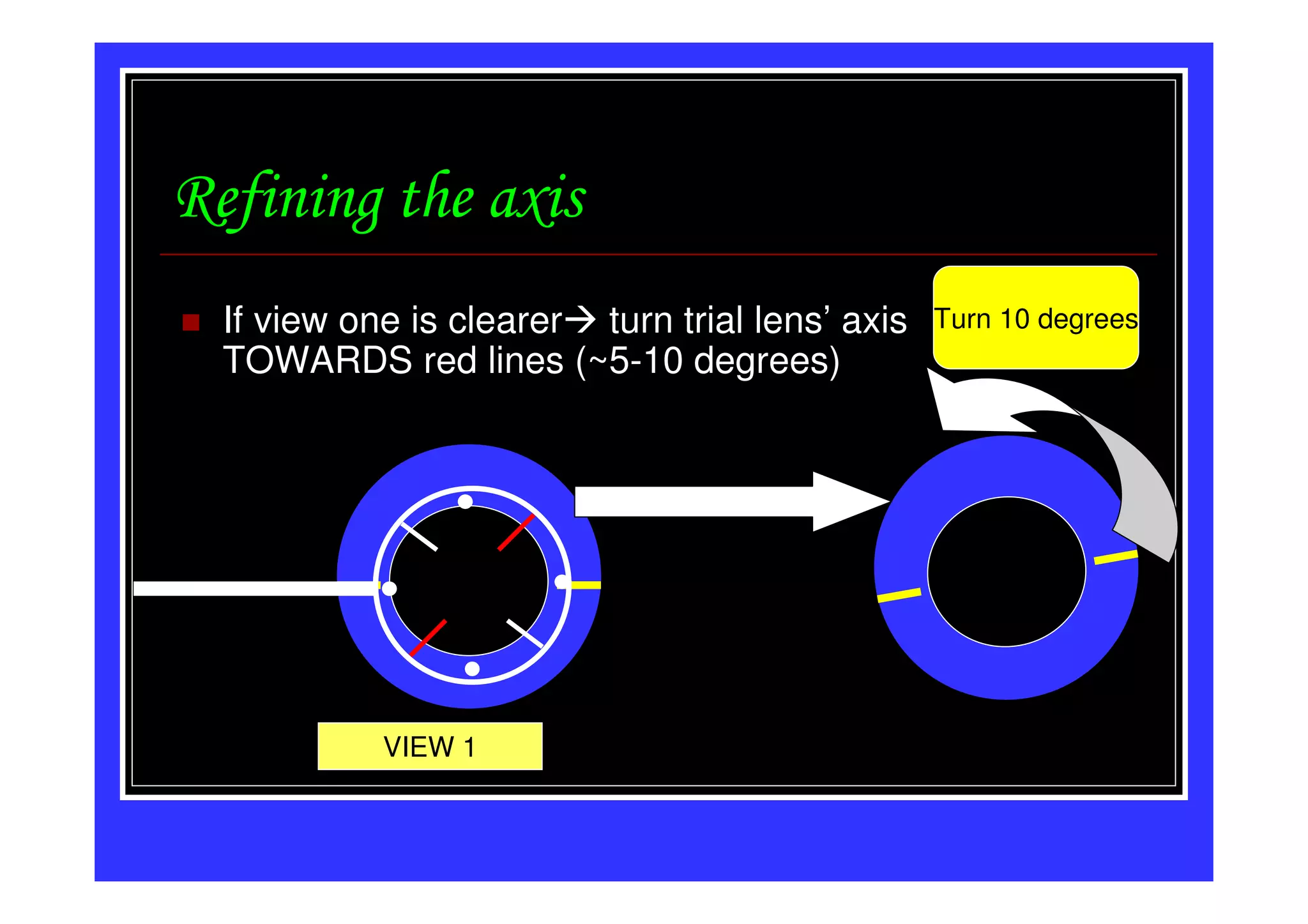 subjective refraction | PDF