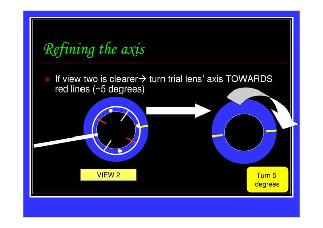 subjective refraction | PDF