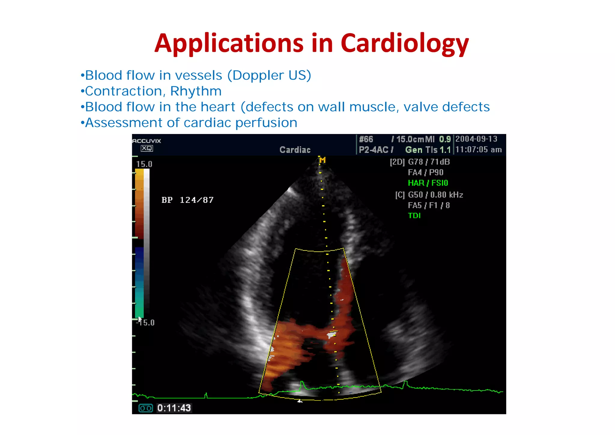 Basics of Ultrasound | PDF