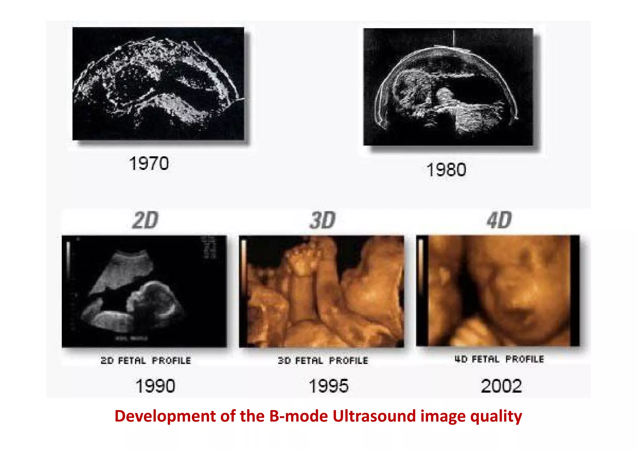 Basics of Ultrasound | PDF