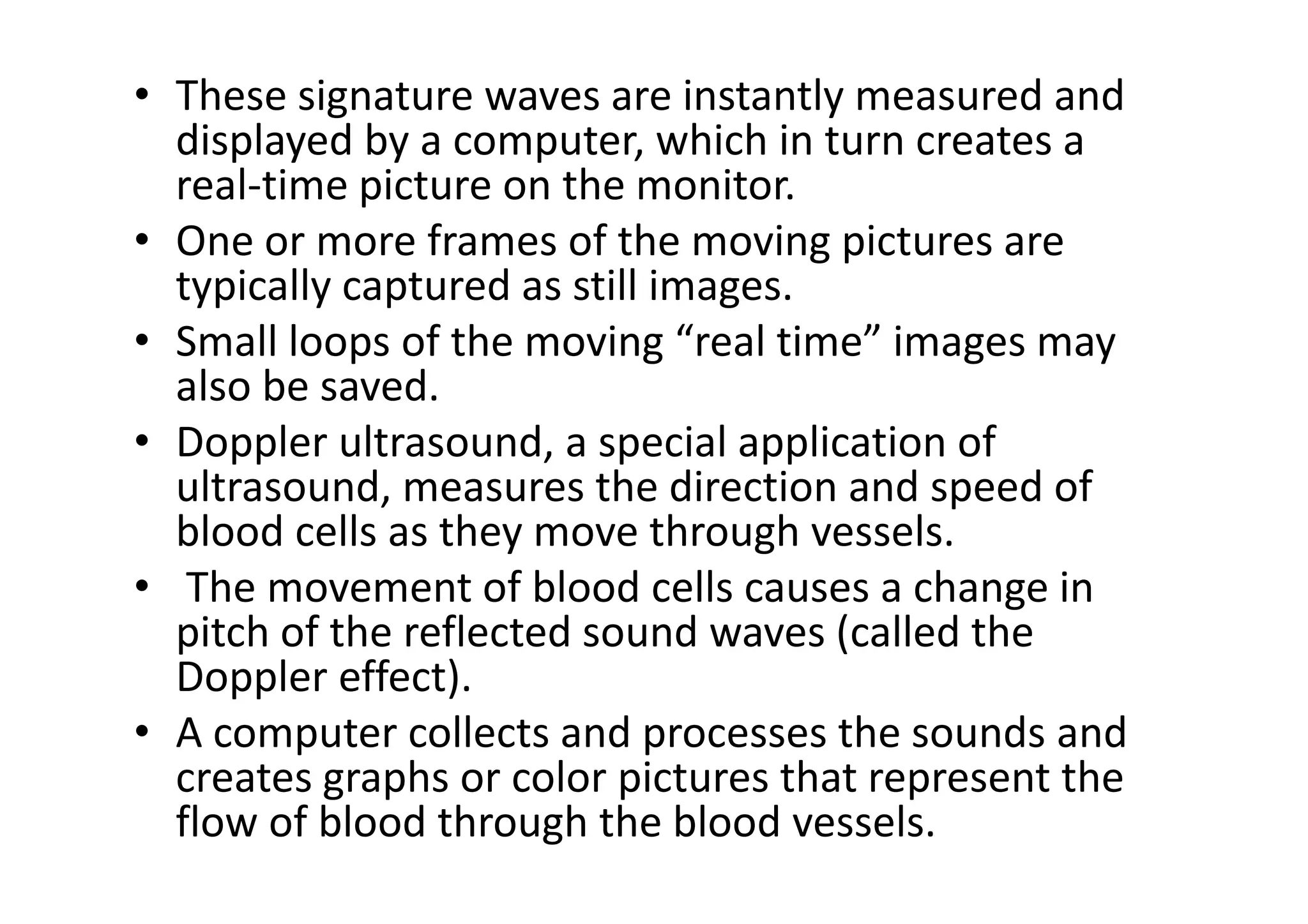 Basics of Ultrasound | PDF