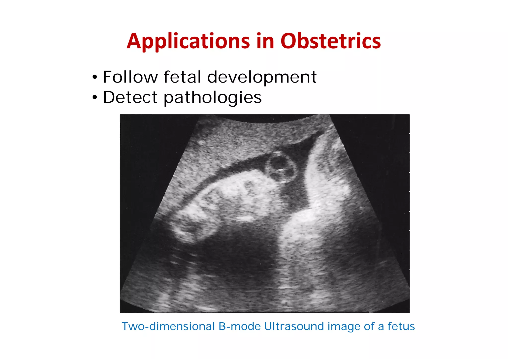 Basics of Ultrasound | PDF