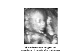 Basics of Ultrasound | PDF