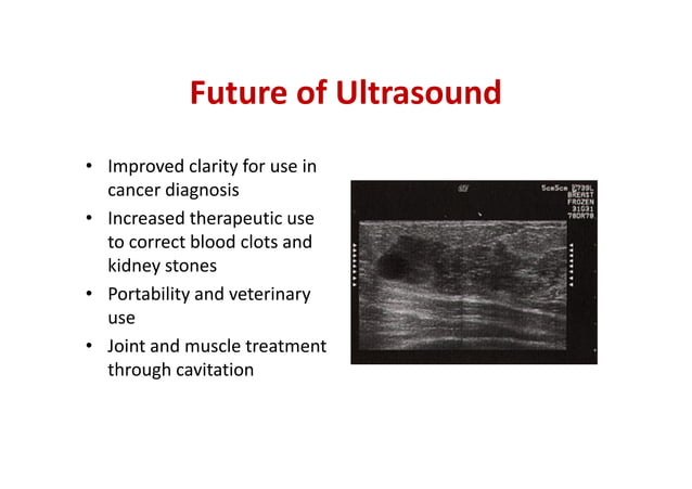 Basics of Ultrasound | PDF