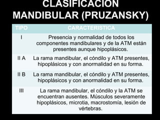 Microsomia hemifacial y hiperplasia condilar | PPT