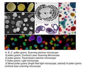 MICROSOPE TYPES PPT CAMBRIDGE AS BIOLOGY | PPT