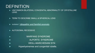 Microspherophakia | PPTX