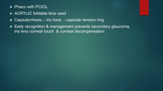 Microspherophakia | PPTX