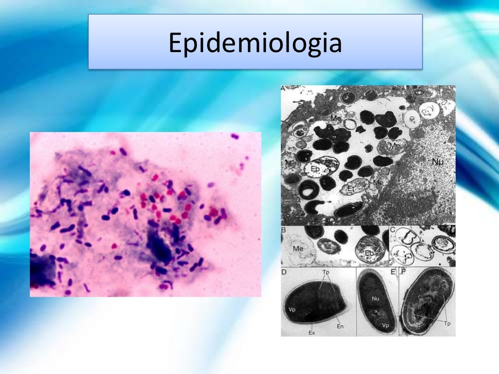 Microsporidiosis