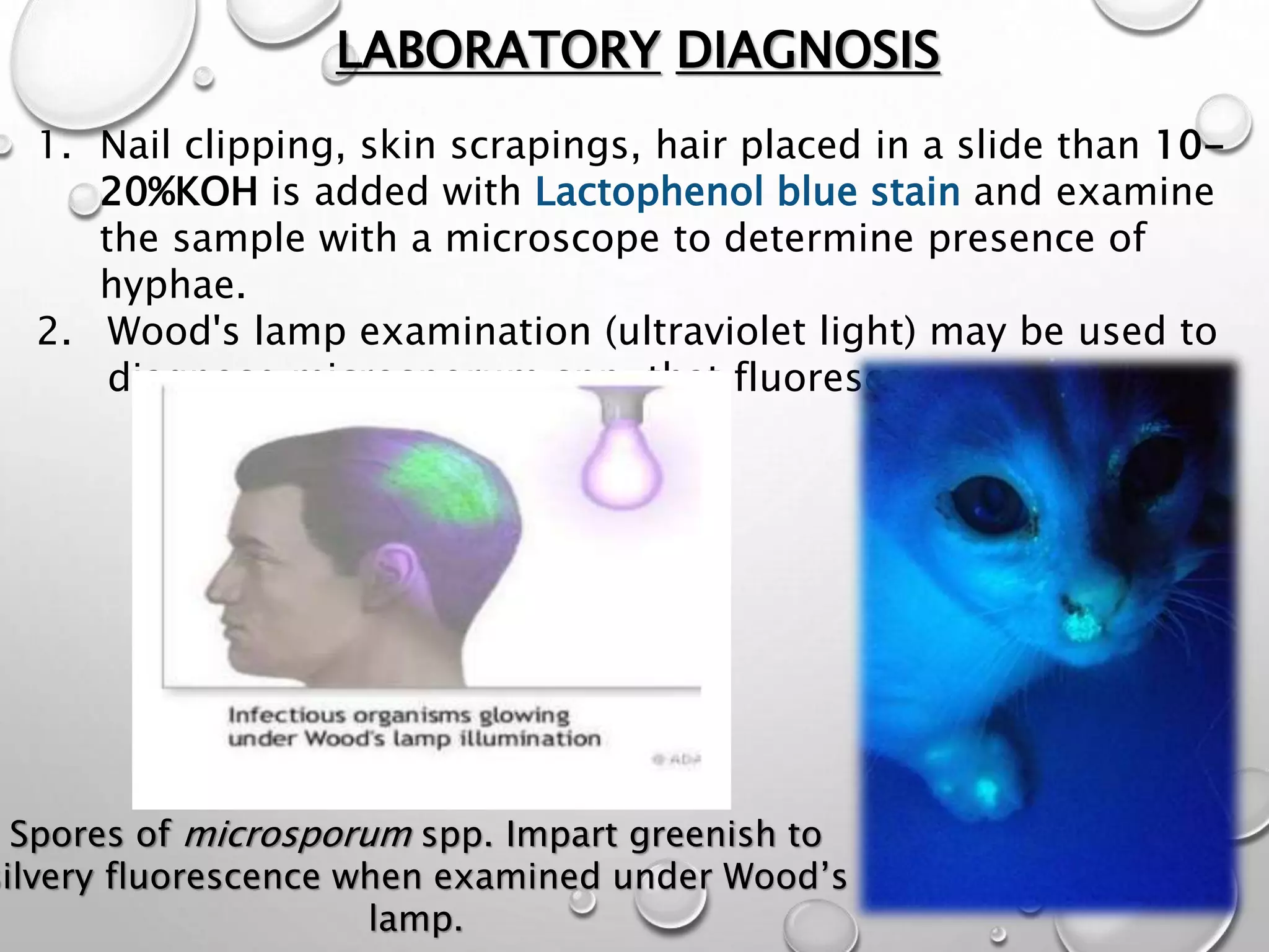 Microsporum fungi. | PPTX