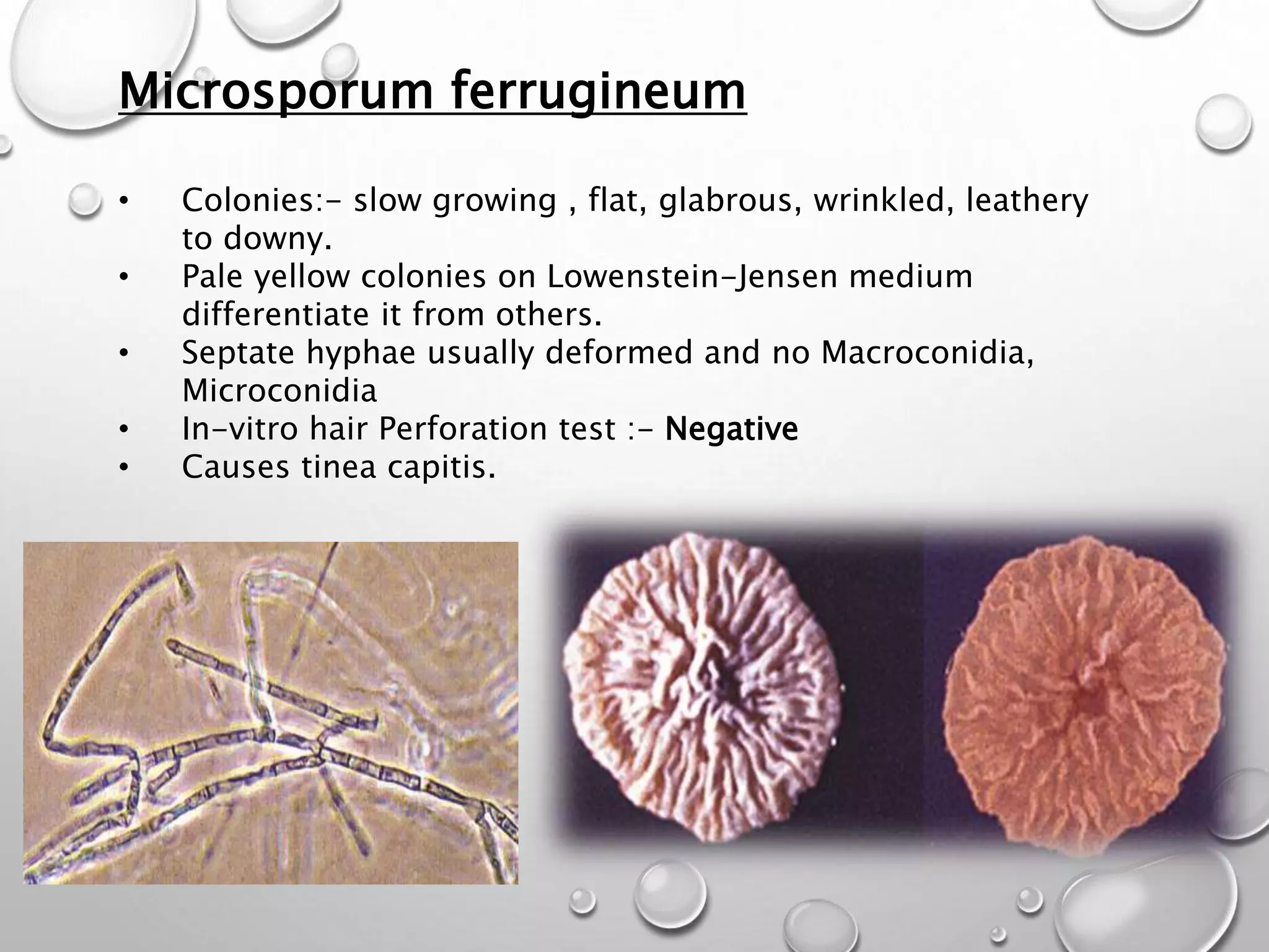 Microsporum fungi. | PPTX