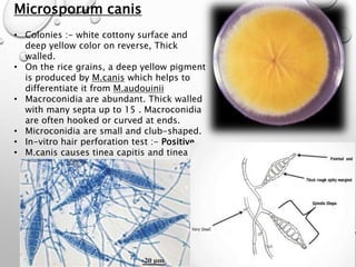 Microsporum fungi. | PPTX