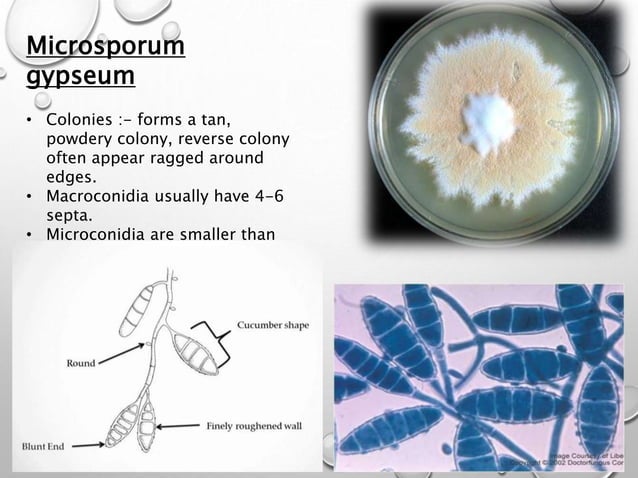Microsporum fungi. | PPTX | Skin and Dermatology | Diseases and Conditions