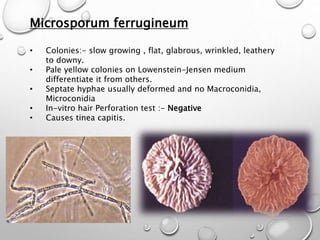 Microsporum fungi. | PPTX