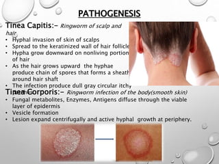 Microsporum fungi. | PPTX