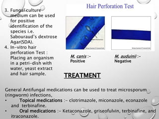 Microsporum fungi. | PPT