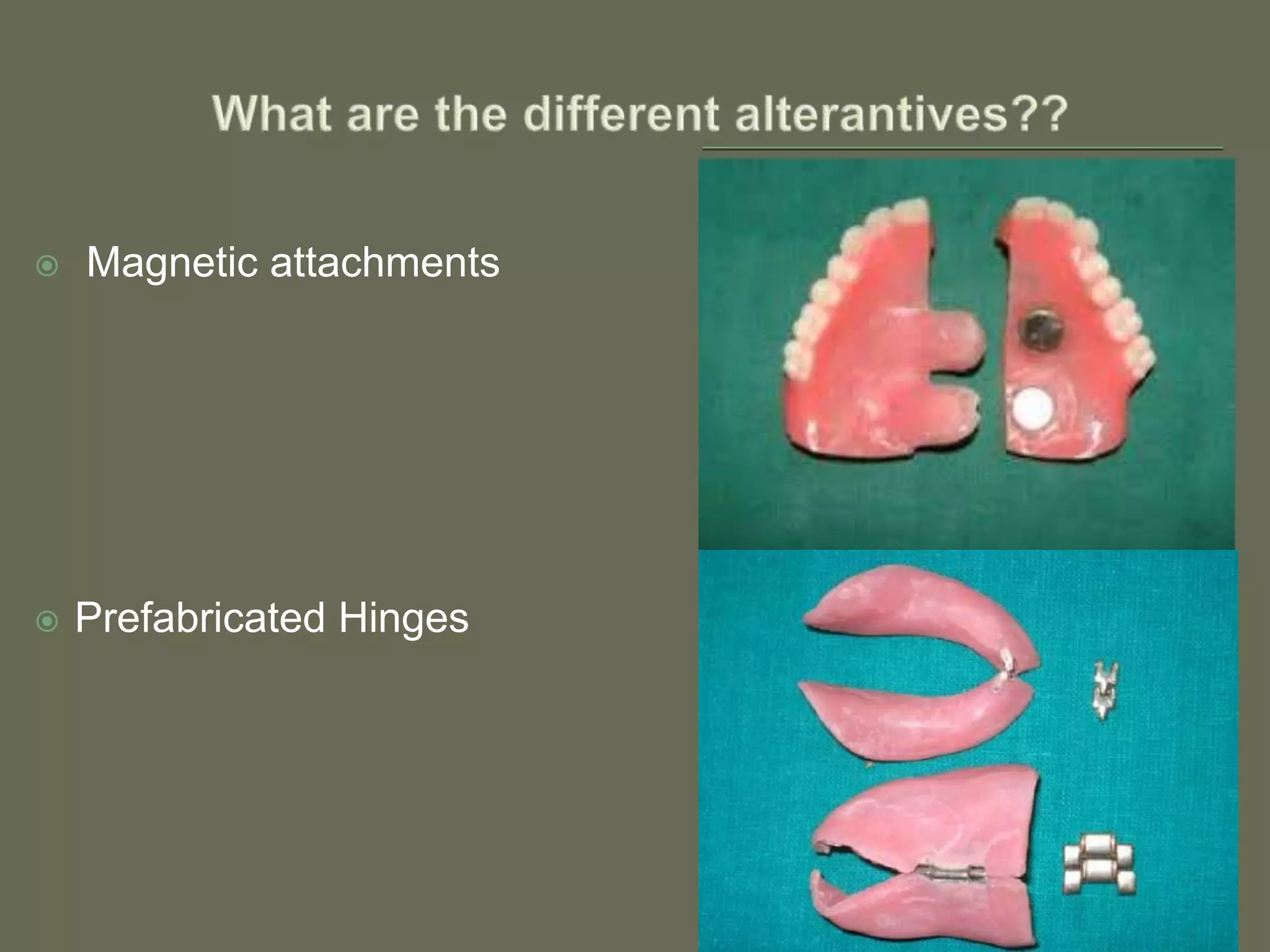 Microstomia- Prosthetic Managemnt of edentulous arches | PPTX